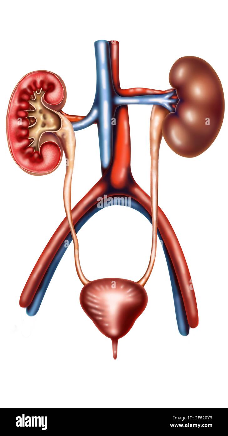 Acute nephritis hi-res stock photography and images - Alamy