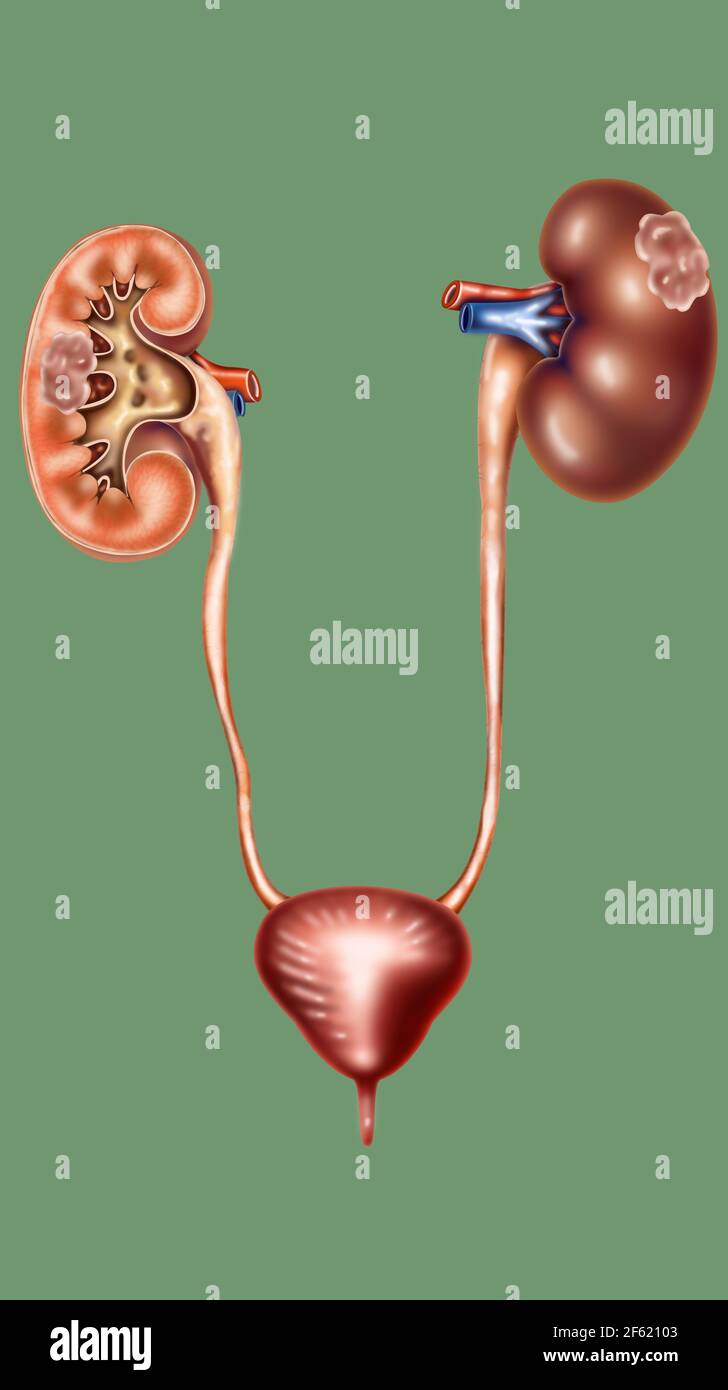 Human Kidney Dissection