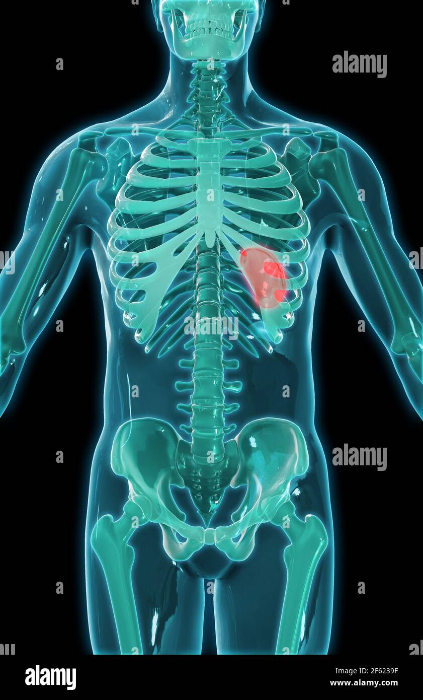 Spleen anatomy hi-res stock photography and images - Alamy