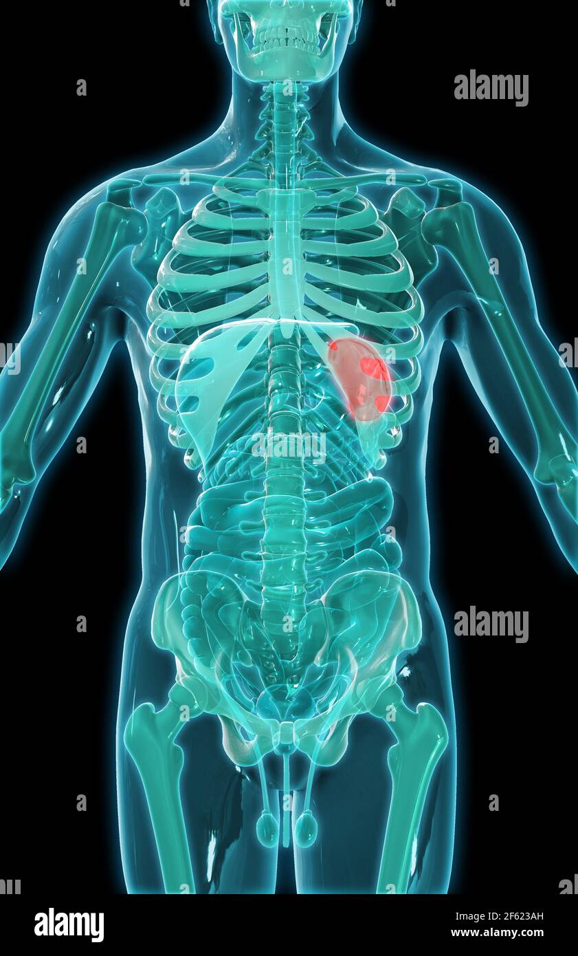 Spleen anatomy hi-res stock photography and images - Alamy