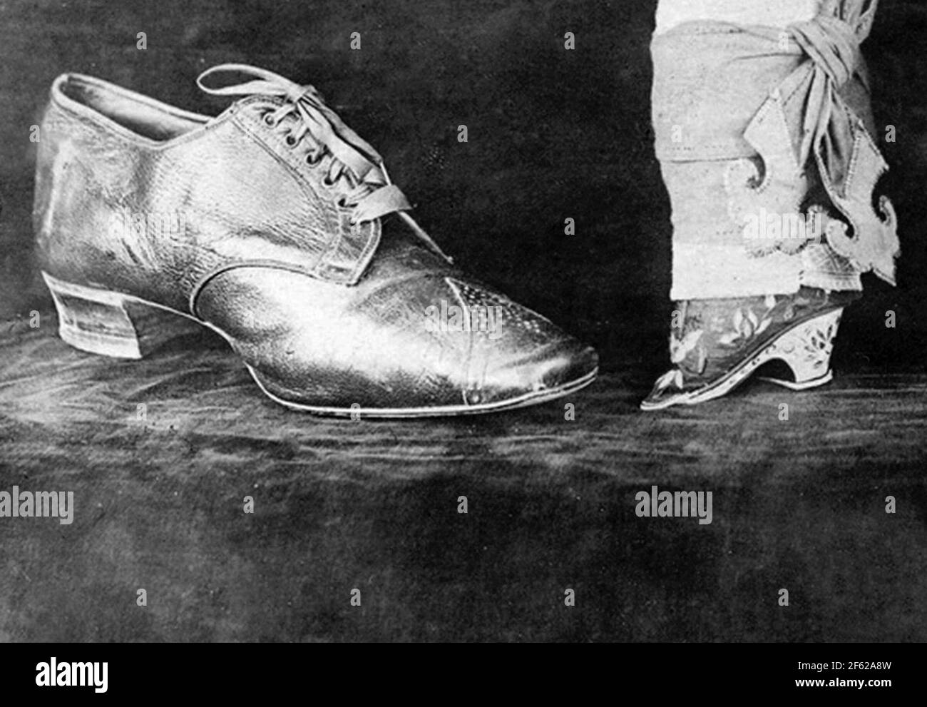 Bound foot Black and White Stock Photos & Images - Alamy