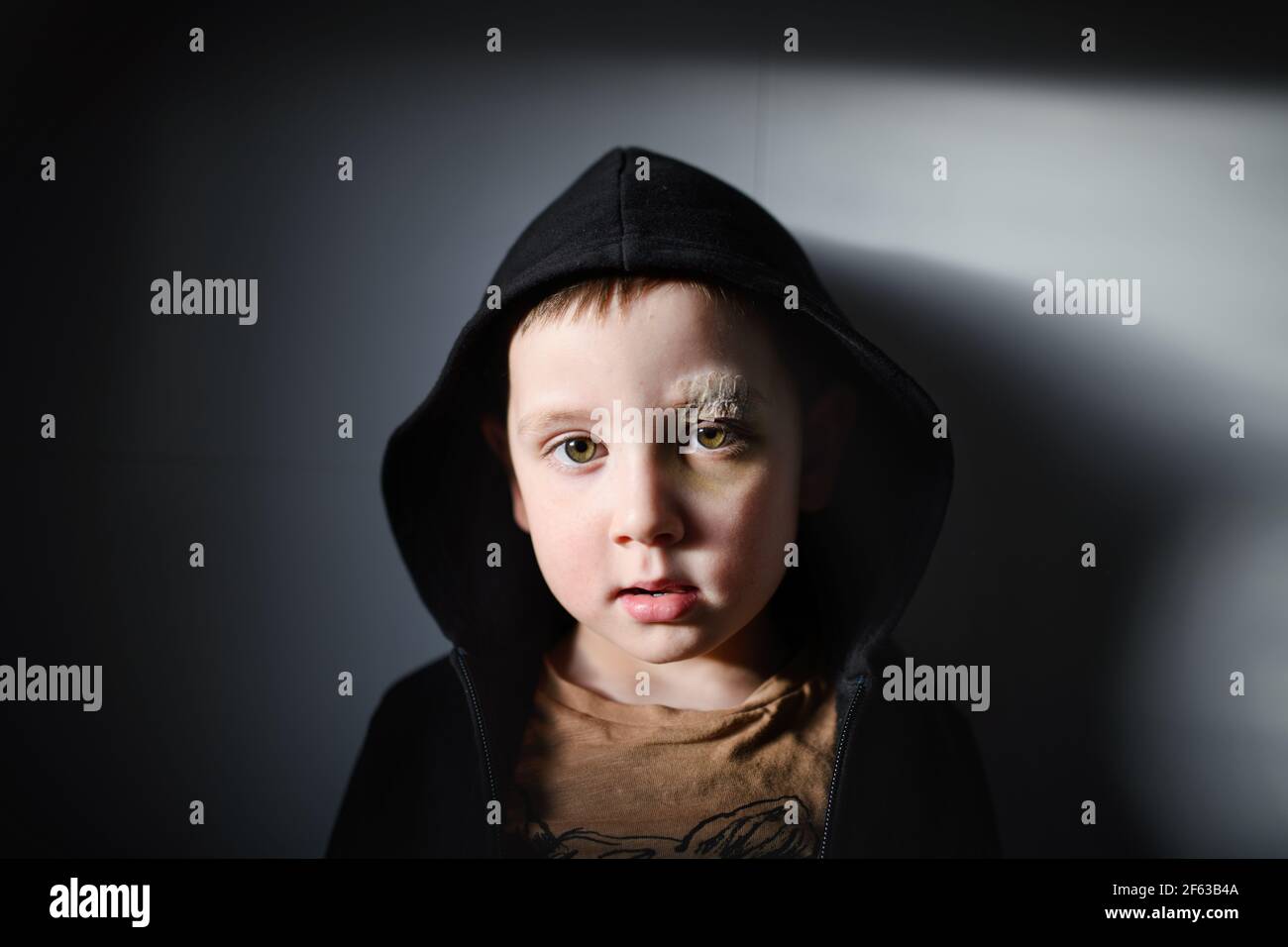 Poor sad small boy with cut eyebrow standing indoors at home, poverty ...