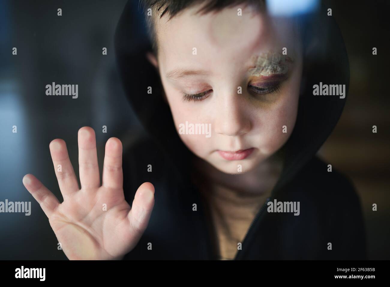 Poor sad small boy with cut eyebrow standing indoors at home, poverty ...