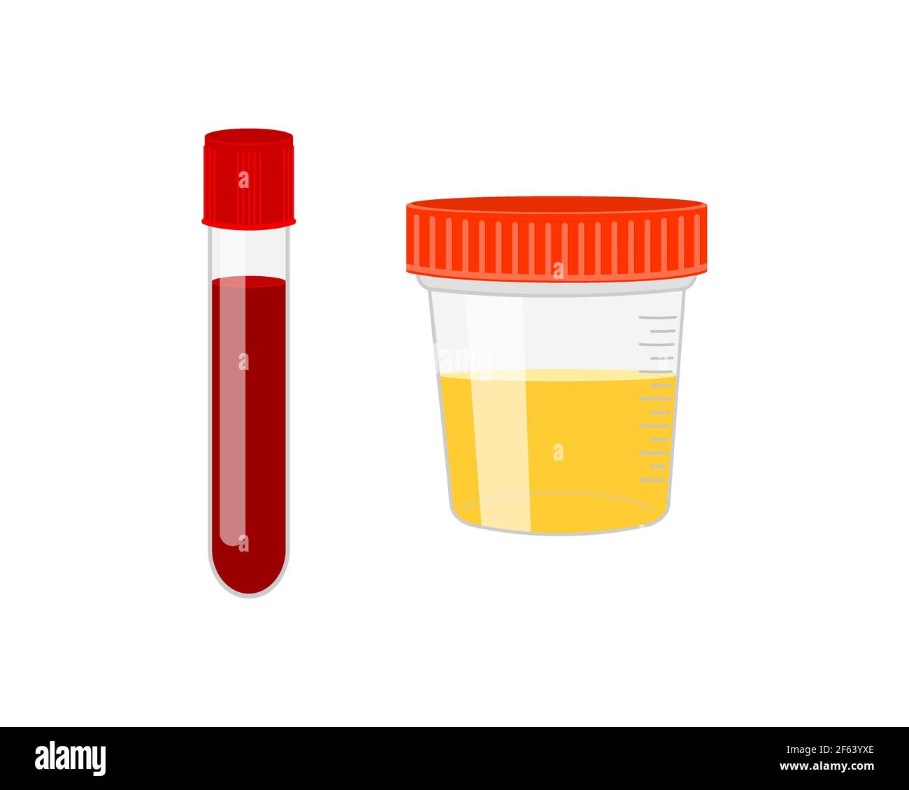 Test tube with blood and urine sample container isolated on white ...
