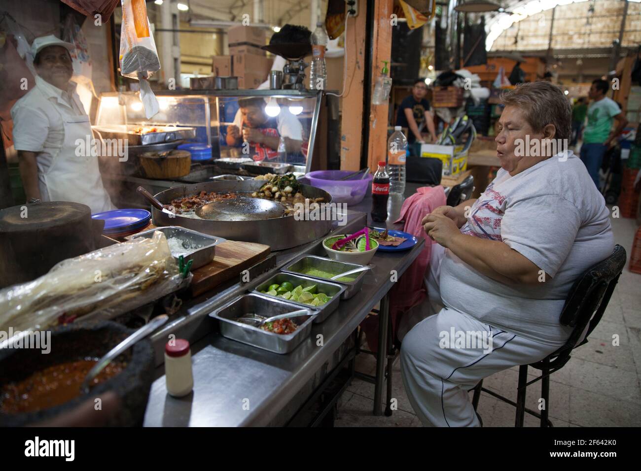 Severe morbid obesity hi-res stock photography and images - Alamy