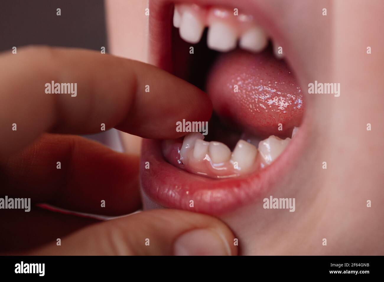 Teeth Falling Out Clipart Flower