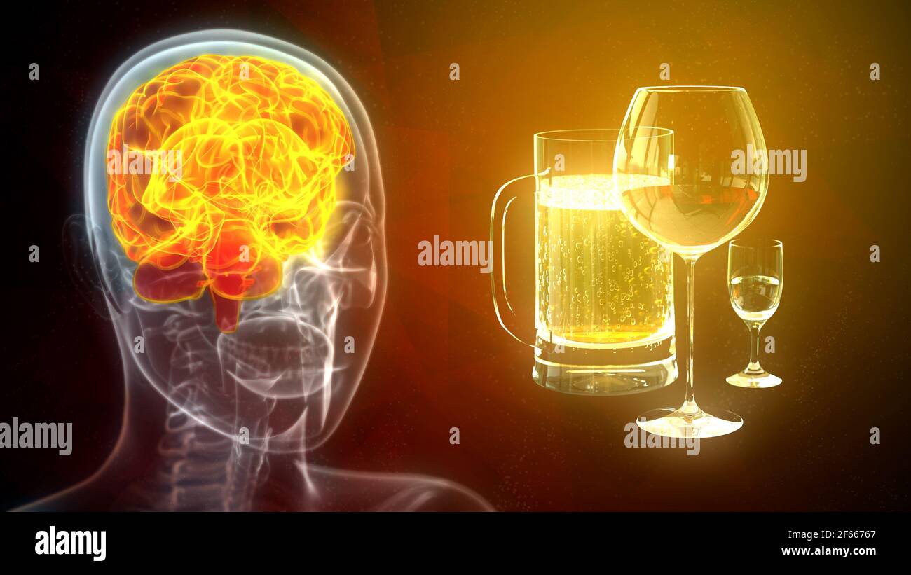 human affected by alcohol, cg healthcare 3d illustration Stock Photo ...
