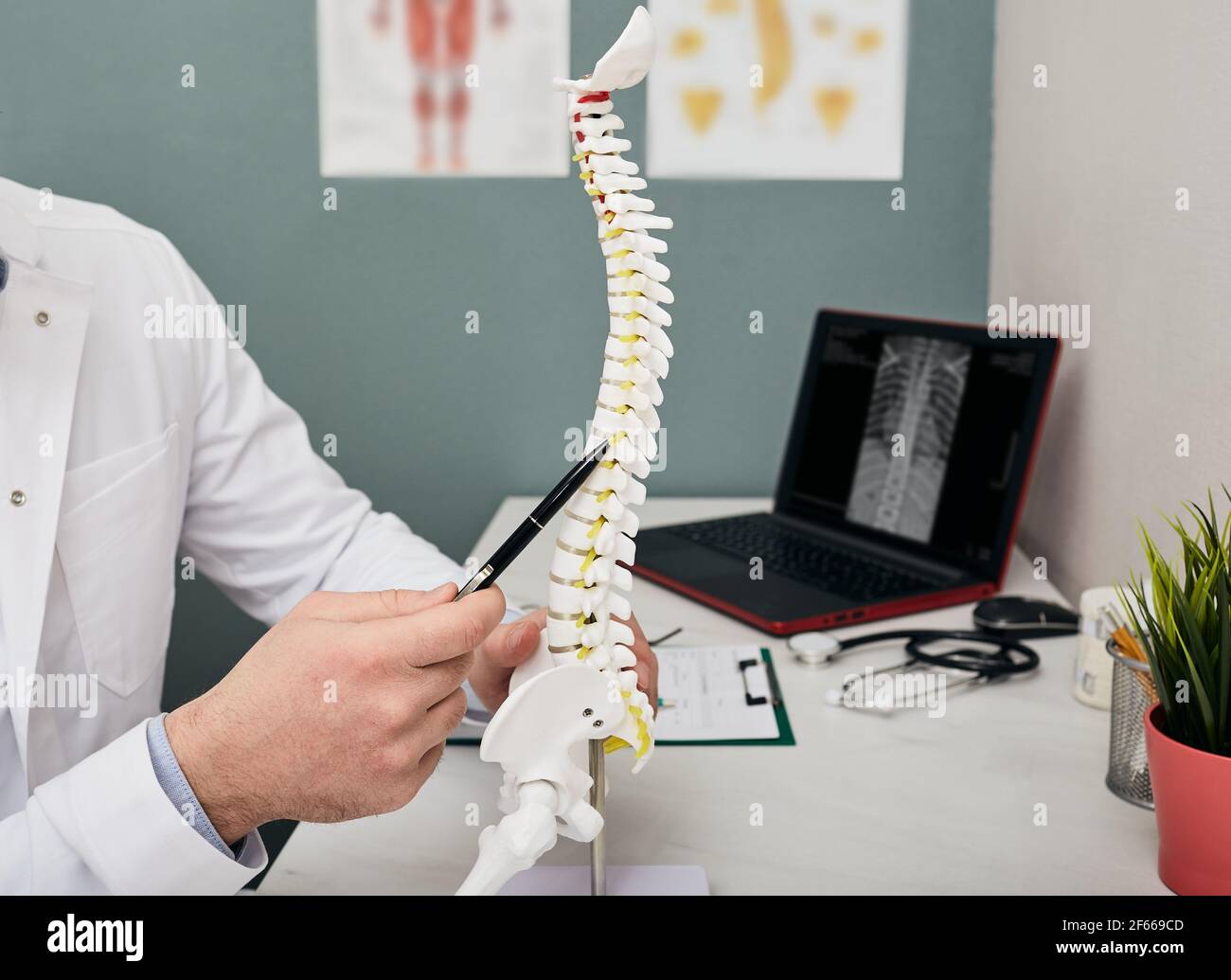 doctor shows problem points on a spine using a spine anatomical model ...