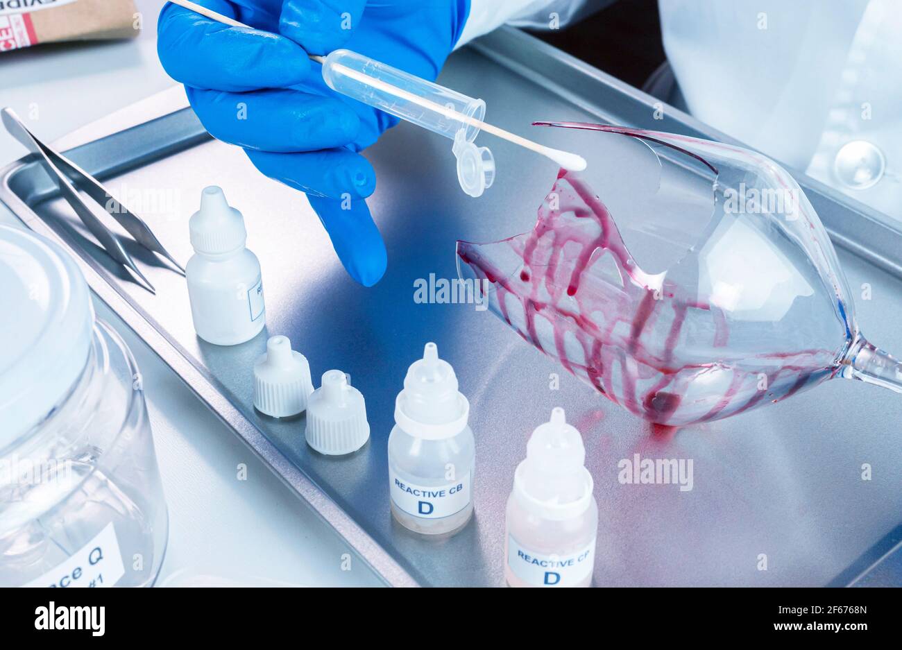 Police expert gets blood sample from a broken glass bottle in ...