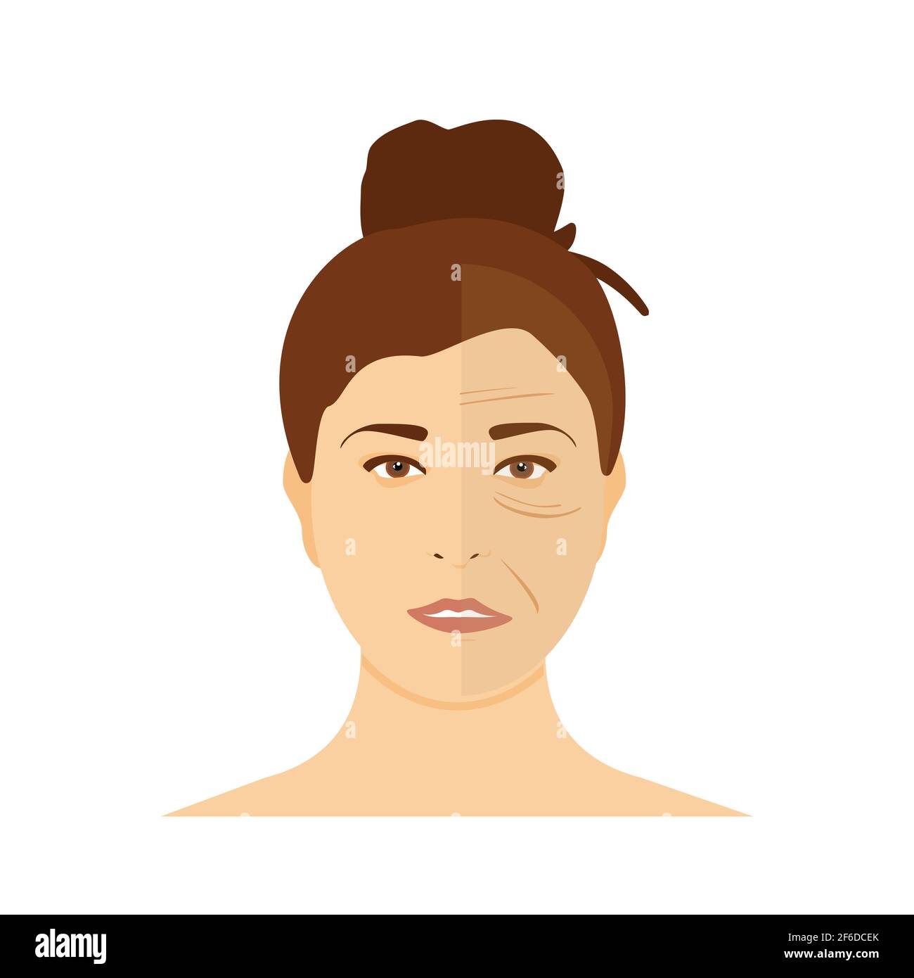 Mature Woman Face Before And After Cosmetic Procedure Neurotoxin