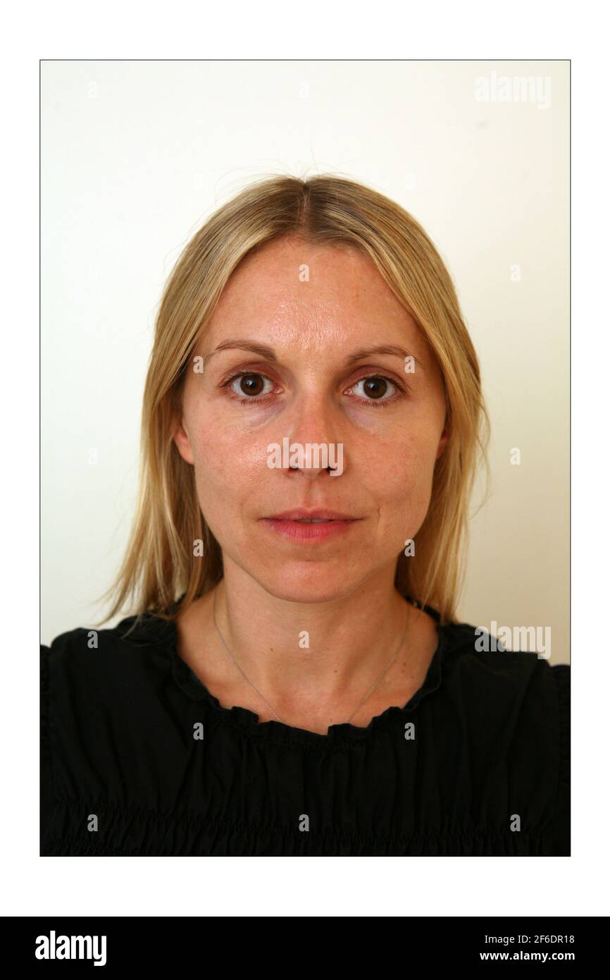 Charlotte Cripps has the first of a series of Photorejuvenation laser ...