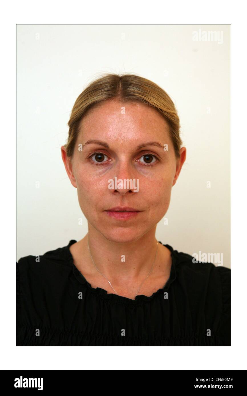 Charlotte Cripps has the first of a series of Photorejuvenation laser ...