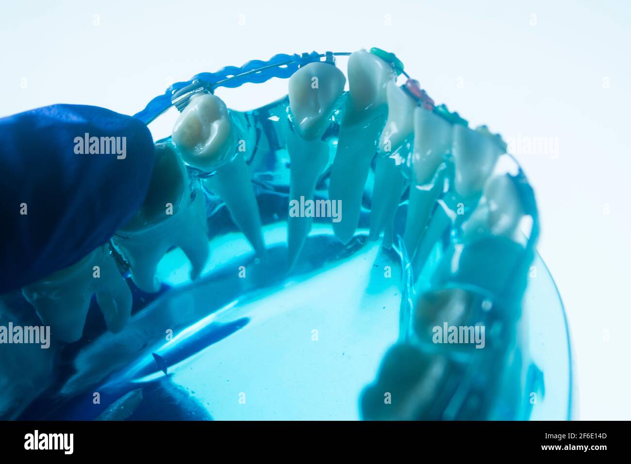 Modern metal brackets aligner straighterners used to correct alignment ...