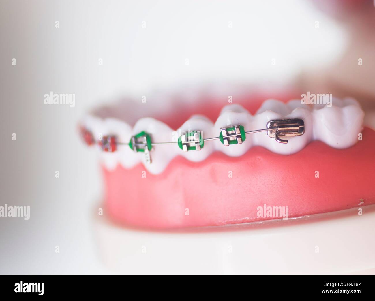 Dental teeth aligner bracket teaching student model showing gums and ...