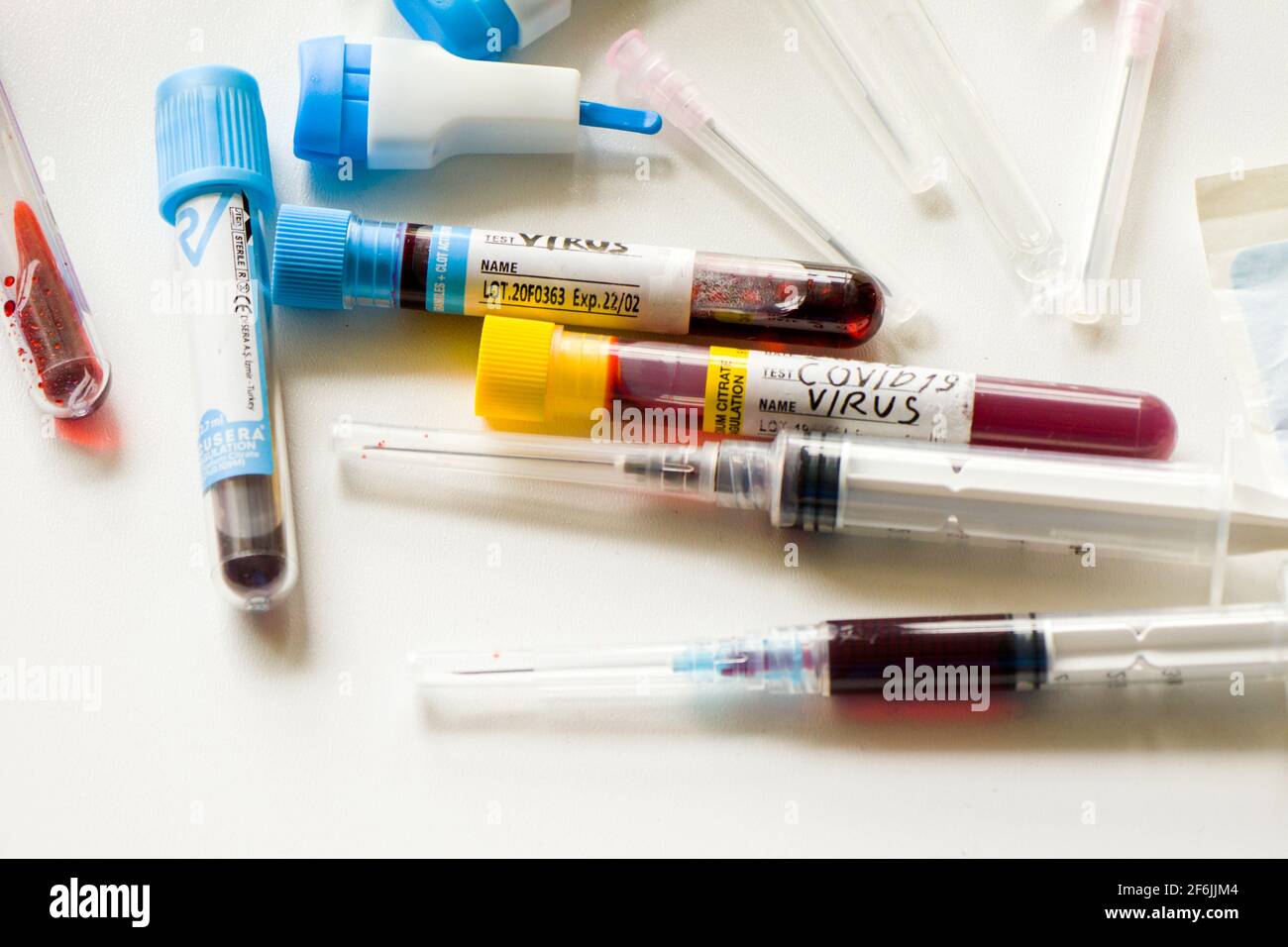Blood test samples, tube and needle for blood test on the white ...