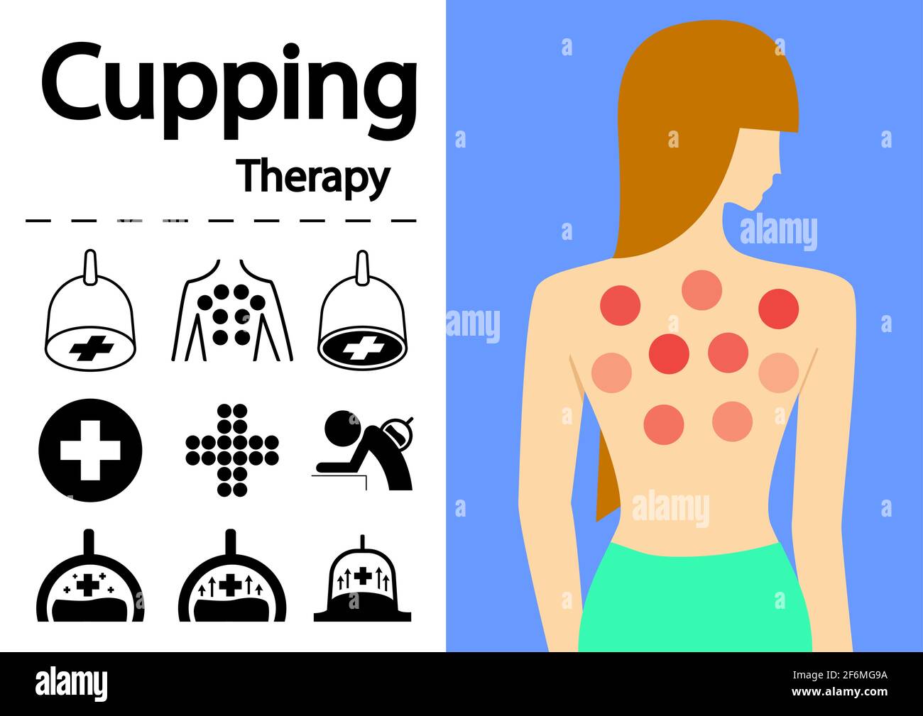Hijama or Cupping Therapy Icons in flat vector art design Stock Vector ...