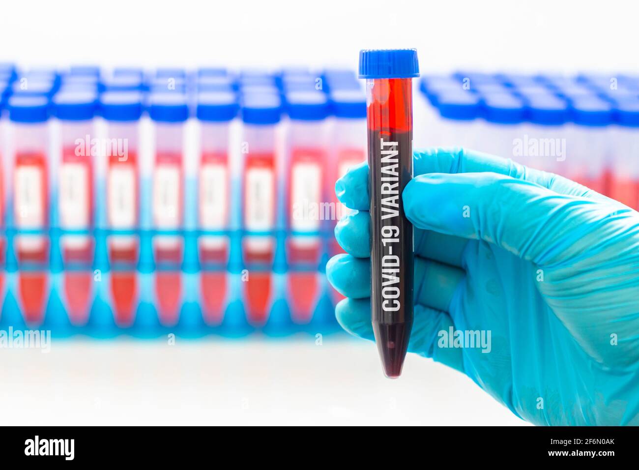 A medical Worker wearing gloves holding a plastic centrifuge tube with ...
