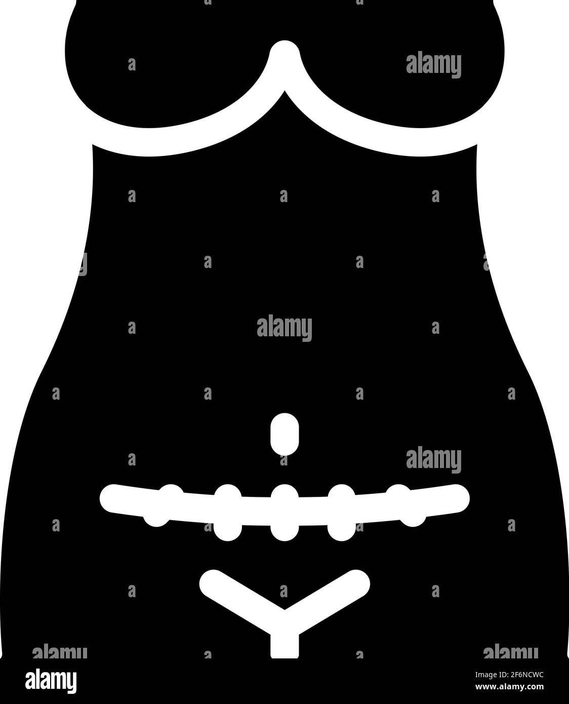 Childbirth, Cesarean Section High Resolution Stock Photography and ...