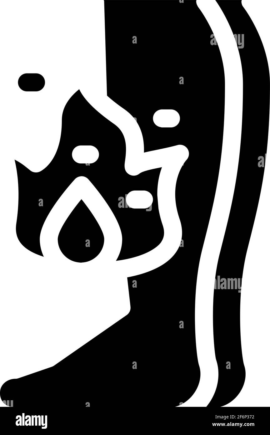 burning pain legs icon vector glyph illustration Stock Vector Image ...