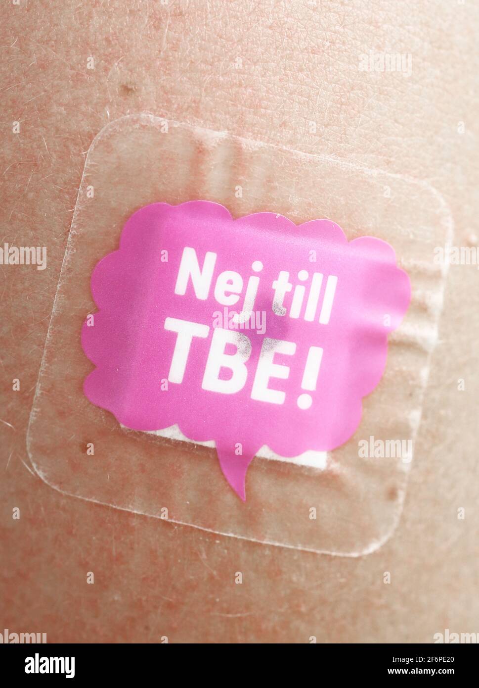 A girl has been given a patch, with the text "No to TBE", after the TBE ...