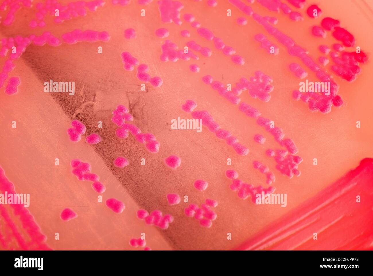 Helicobacter pylori bacteria - Top view Stock Photo - Alamy