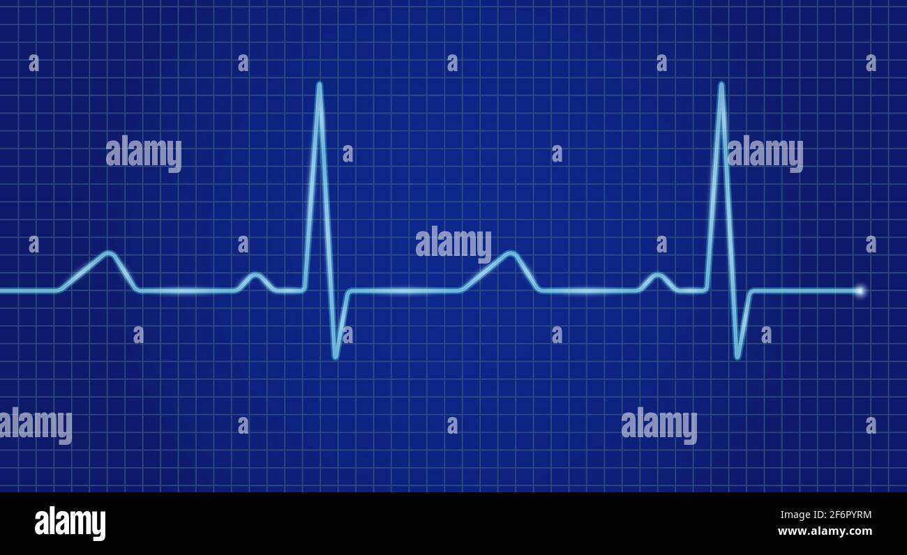 Cardiogram cardiograph oscilloscope blue screen. Heartbeat line ... Cardiogram cardiograph oscilloscope blue screen. Heartbeat line ...