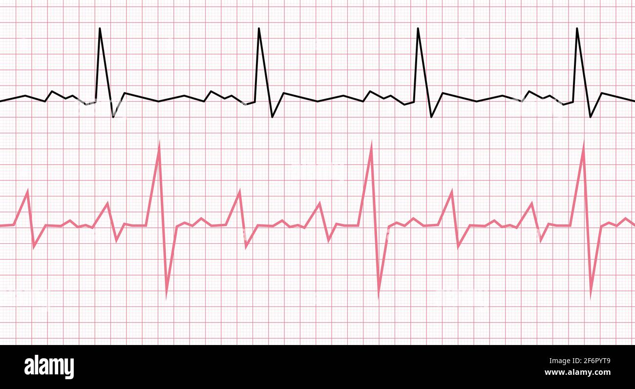 Cardiogram on a graph paper. Electrocardiogram test results. Curves on ...