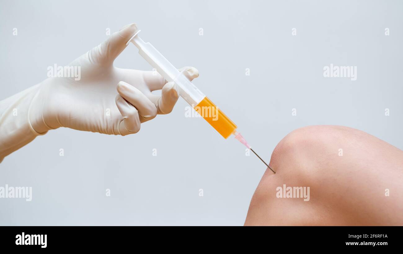 Platelet rich plasma injection hi-res stock photography and images - Alamy