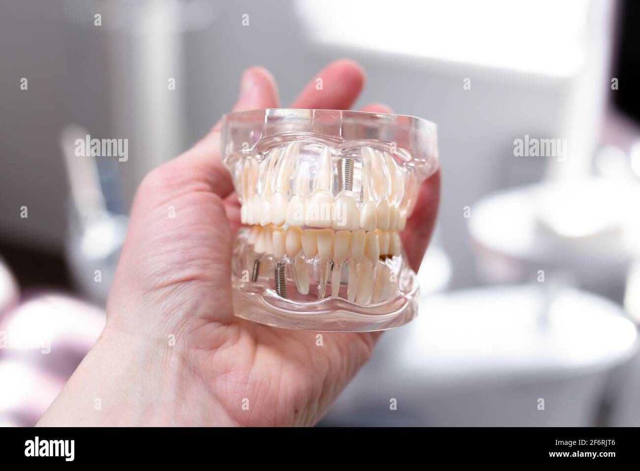 Teeth sample model hi-res stock photography and images - Alamy