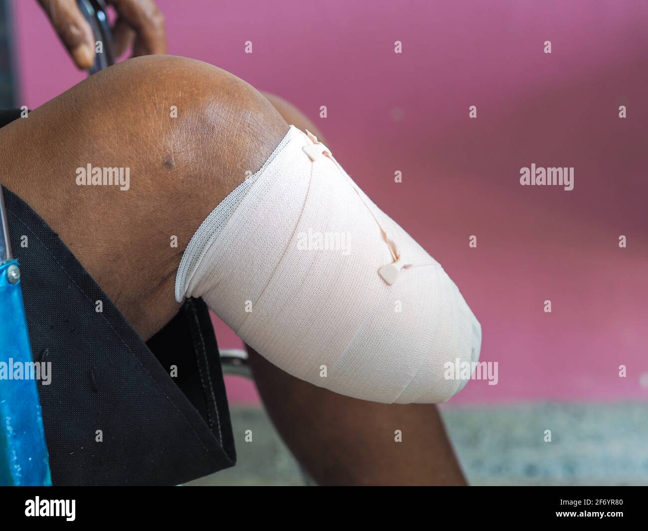 Bandaged back leg hi-res stock photography and images - Alamy