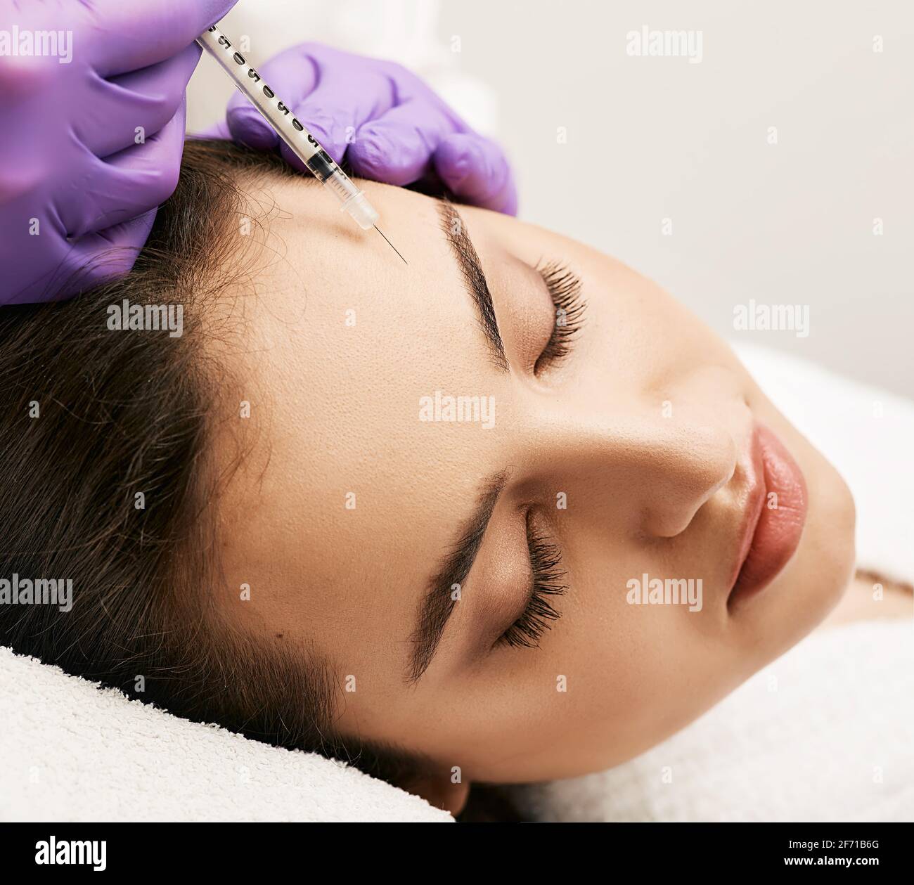Injections in woman forehead wrinkles, blocking mimic wrinkles using ...