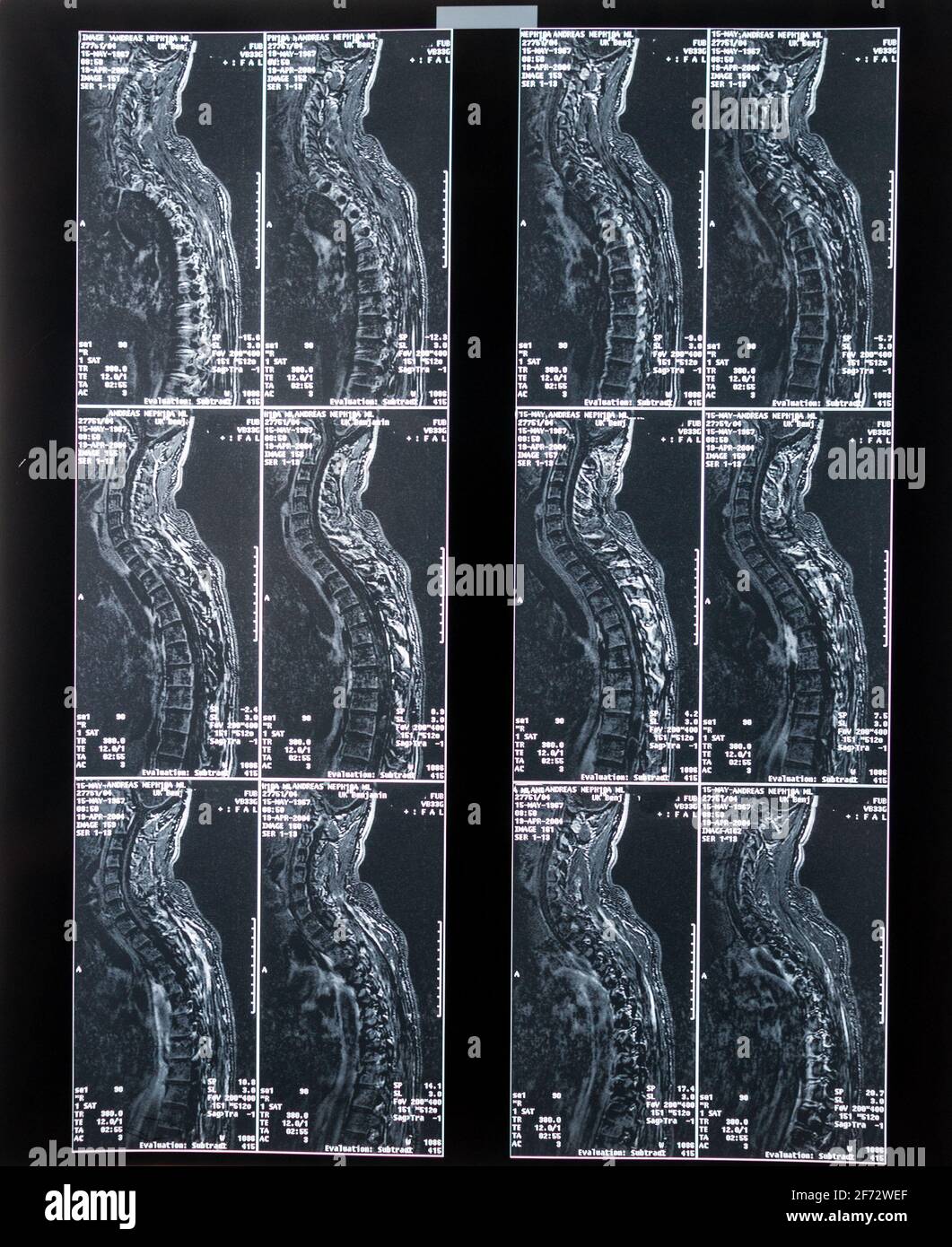 Magnetic resonance imaging, MRI, computed tomography, x-ray image ...