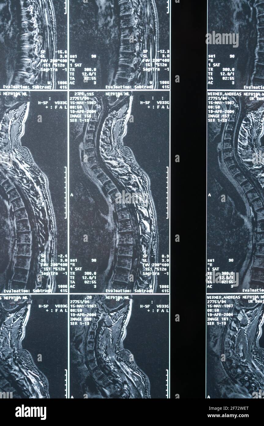 Magnetic resonance imaging, MRI, computed tomography, x-ray image ...