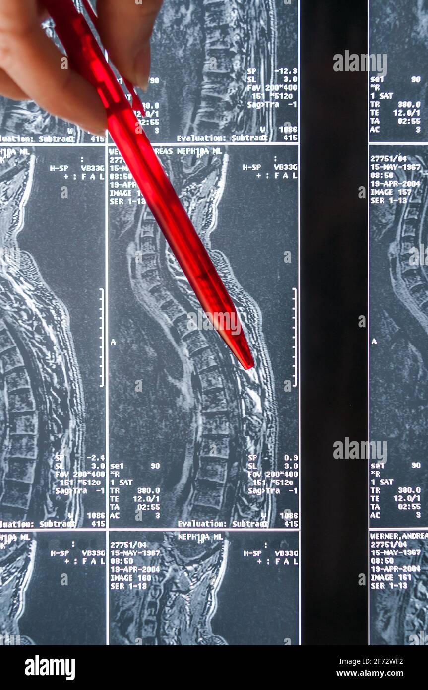 Magnetic resonance imaging, MRI, computed tomography, x-ray image ...