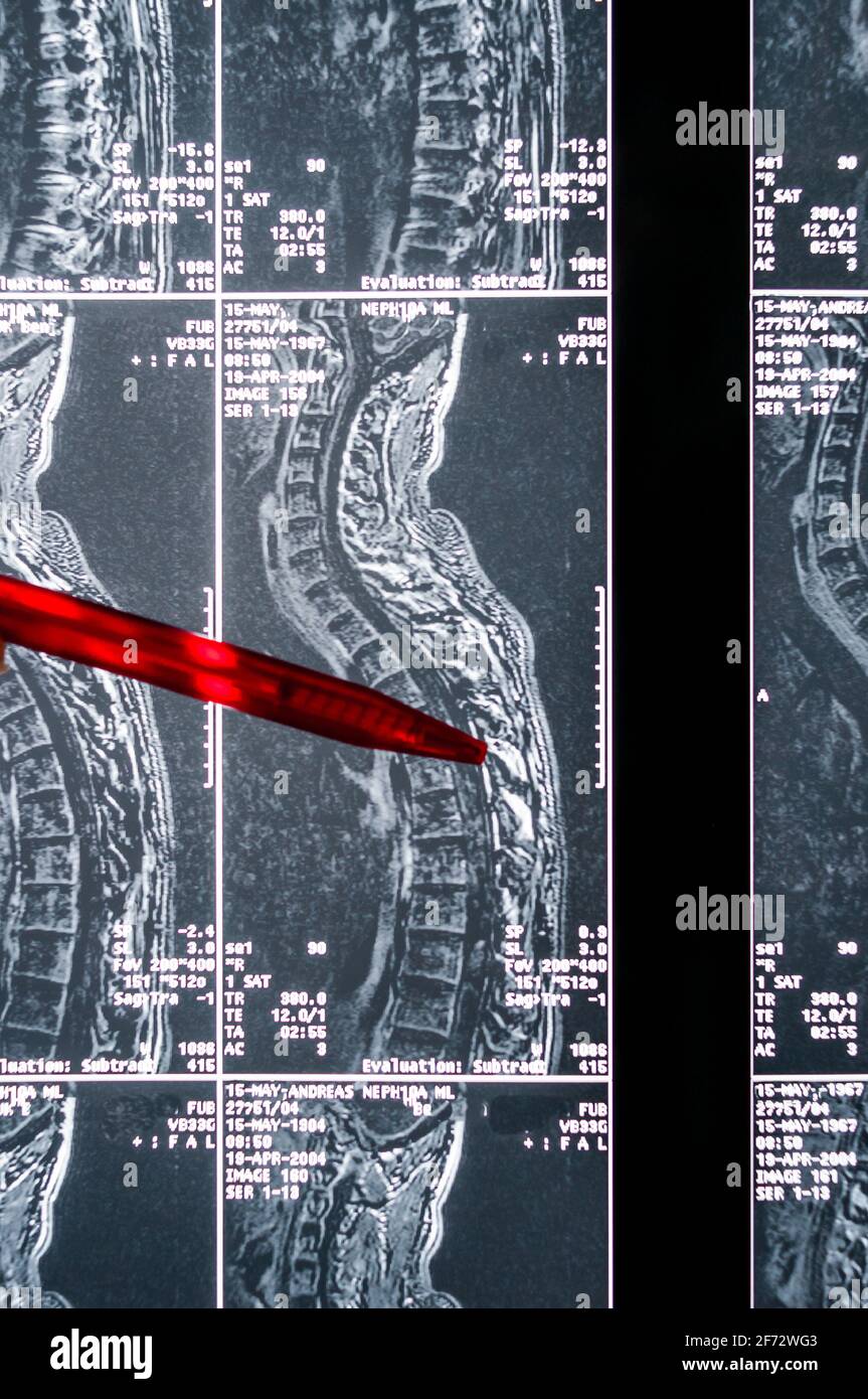 Magnetic resonance imaging, MRI, computed tomography, x-ray image ...