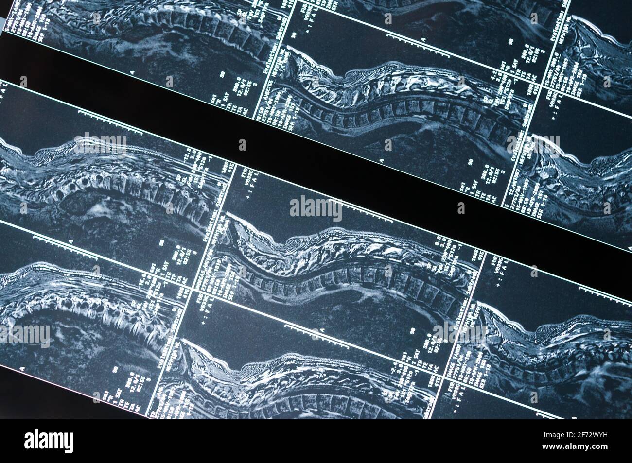 Magnetic resonance imaging, MRI, computed tomography, x-ray image ...