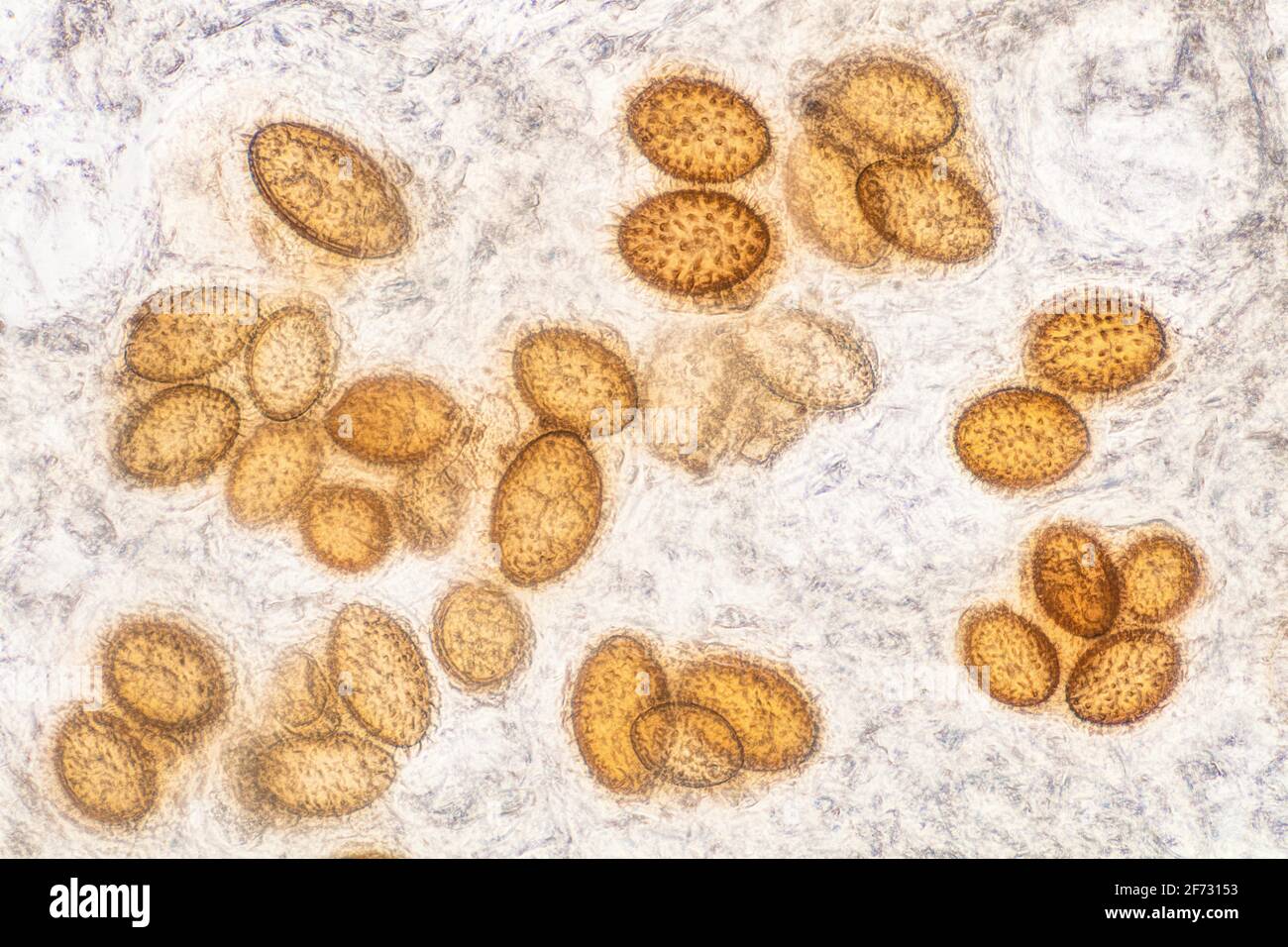 Winter truffle, Muscat truffle (Tuber brumale) Spores Stock Photo - Alamy