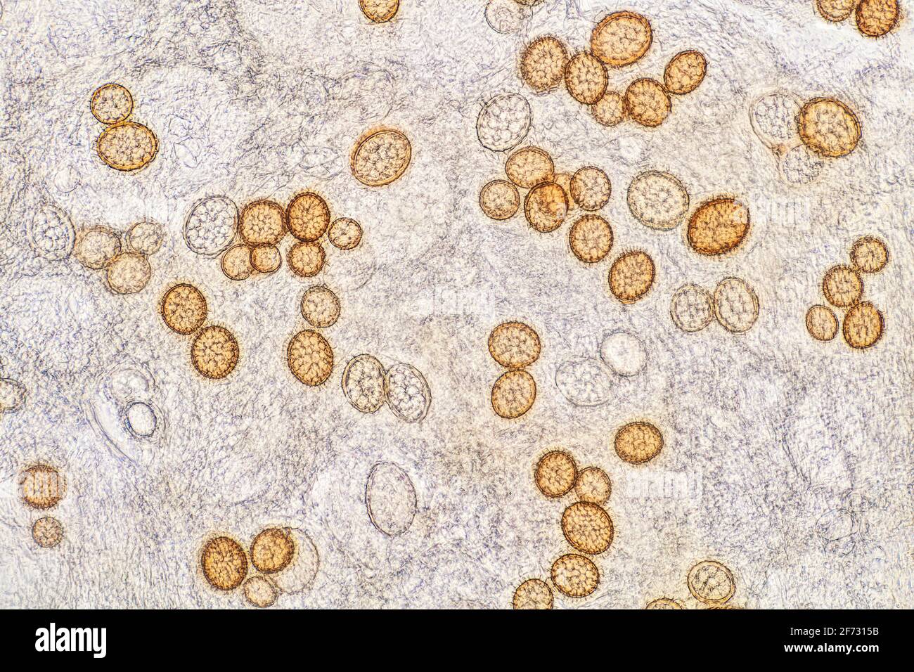 Spring truffle, Biancetti truffle (Tuber borchii) Spores Stock Photo ...