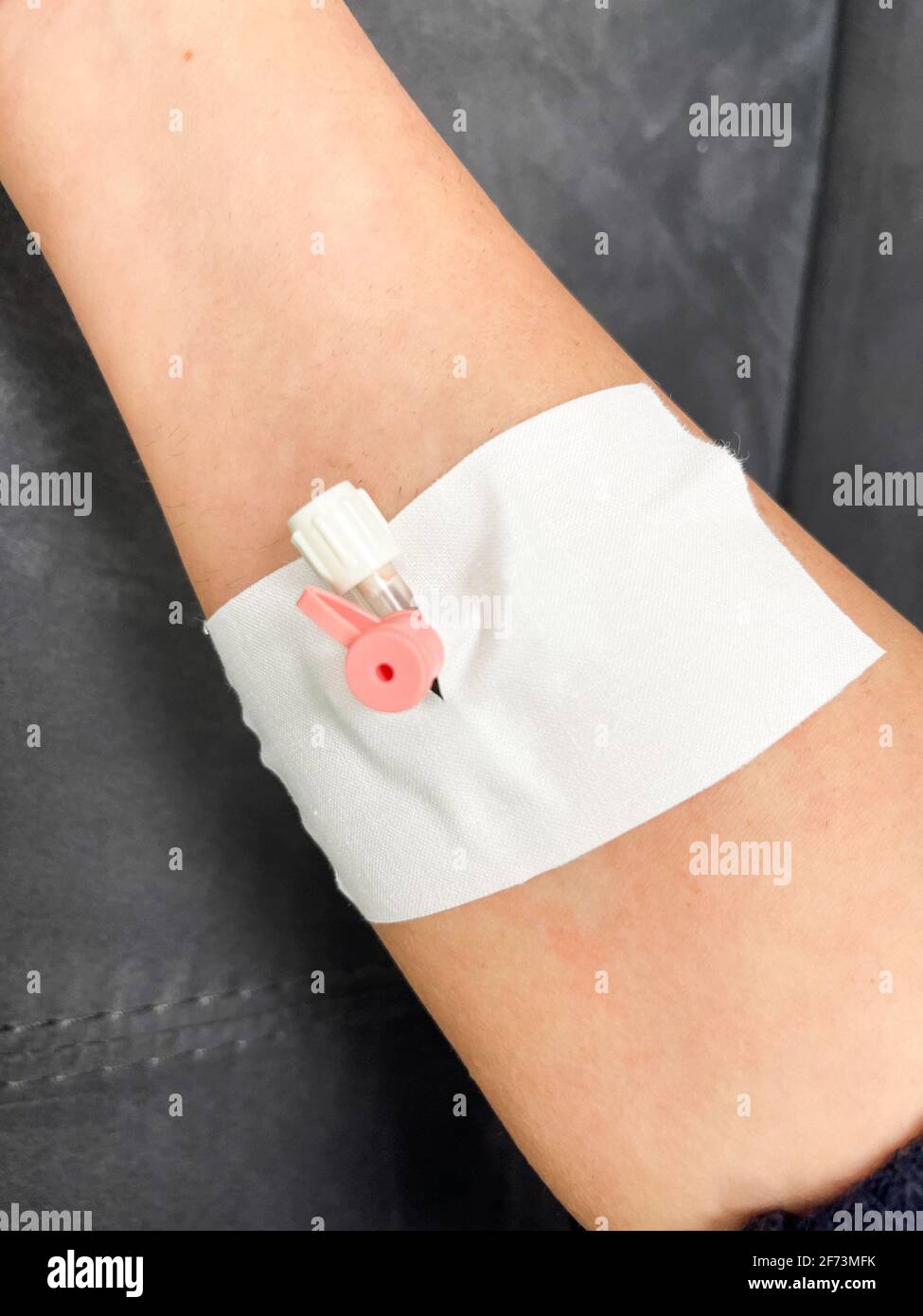 Iv cannula hi-res stock photography and images - Alamy