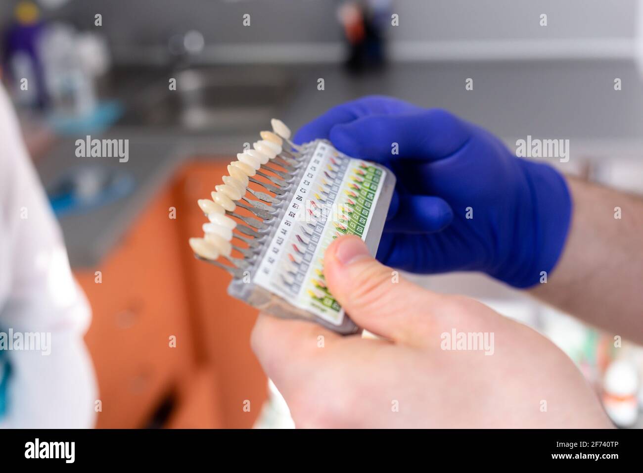 Tooth color chart in the rivers of the dentist. Vita scale Stock Photo ...
