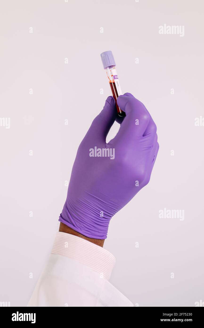 Crop anonymous doctor in medical glove demonstrating test tube with ...