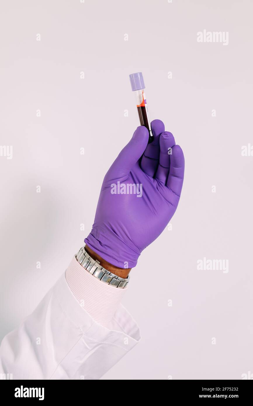 Crop anonymous doctor in medical glove demonstrating test tube with ...