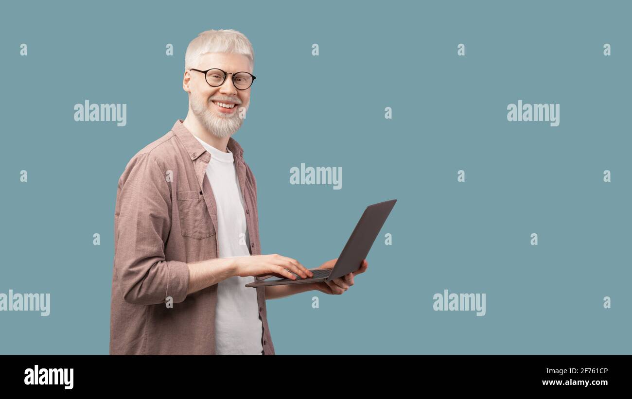 Happy albino man using laptop and looking with smile to camera over ...