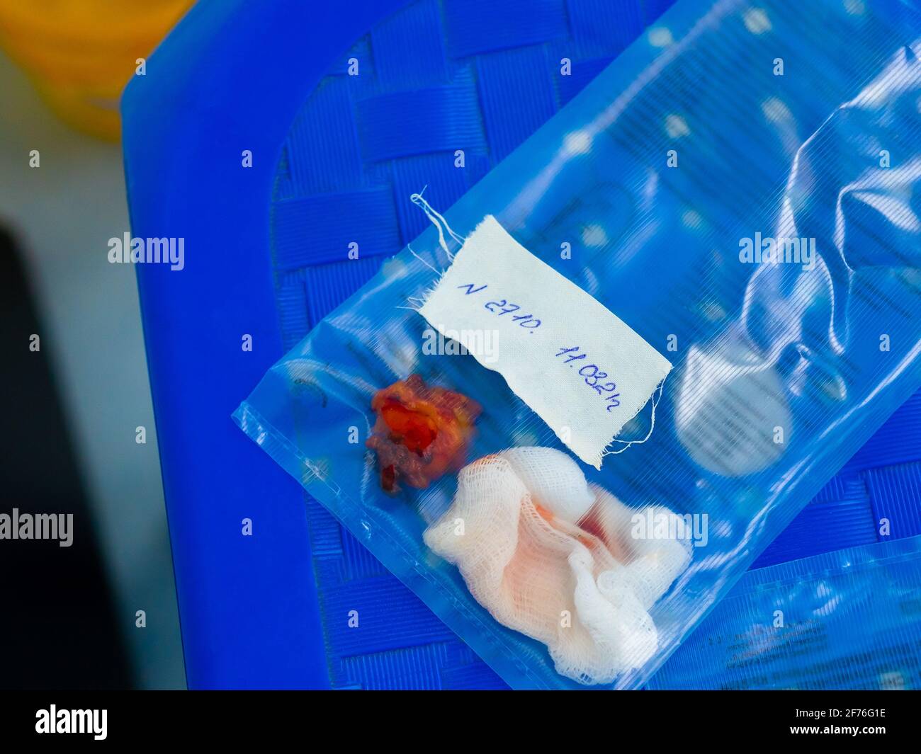 Biological material of human flesh in a transparent bag for ...
