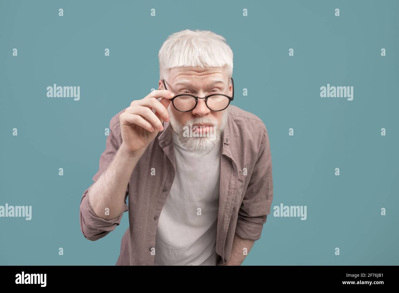 Poor eyesight. Albino man in eyeglasses squinting eyes, having bad ...