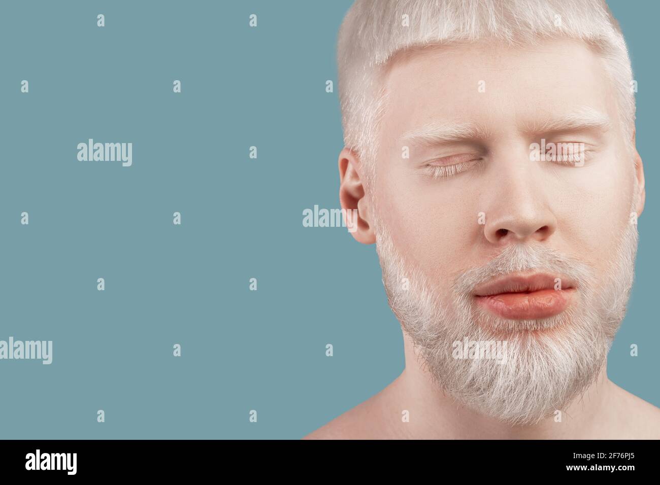 Bearded albino man posing with closed eyes against turquoise studio ...