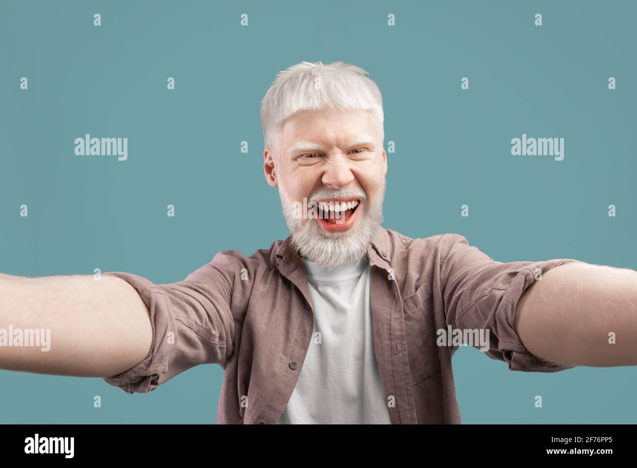 Happy albino guy with unusual appearance taking selfie on turquoise ...