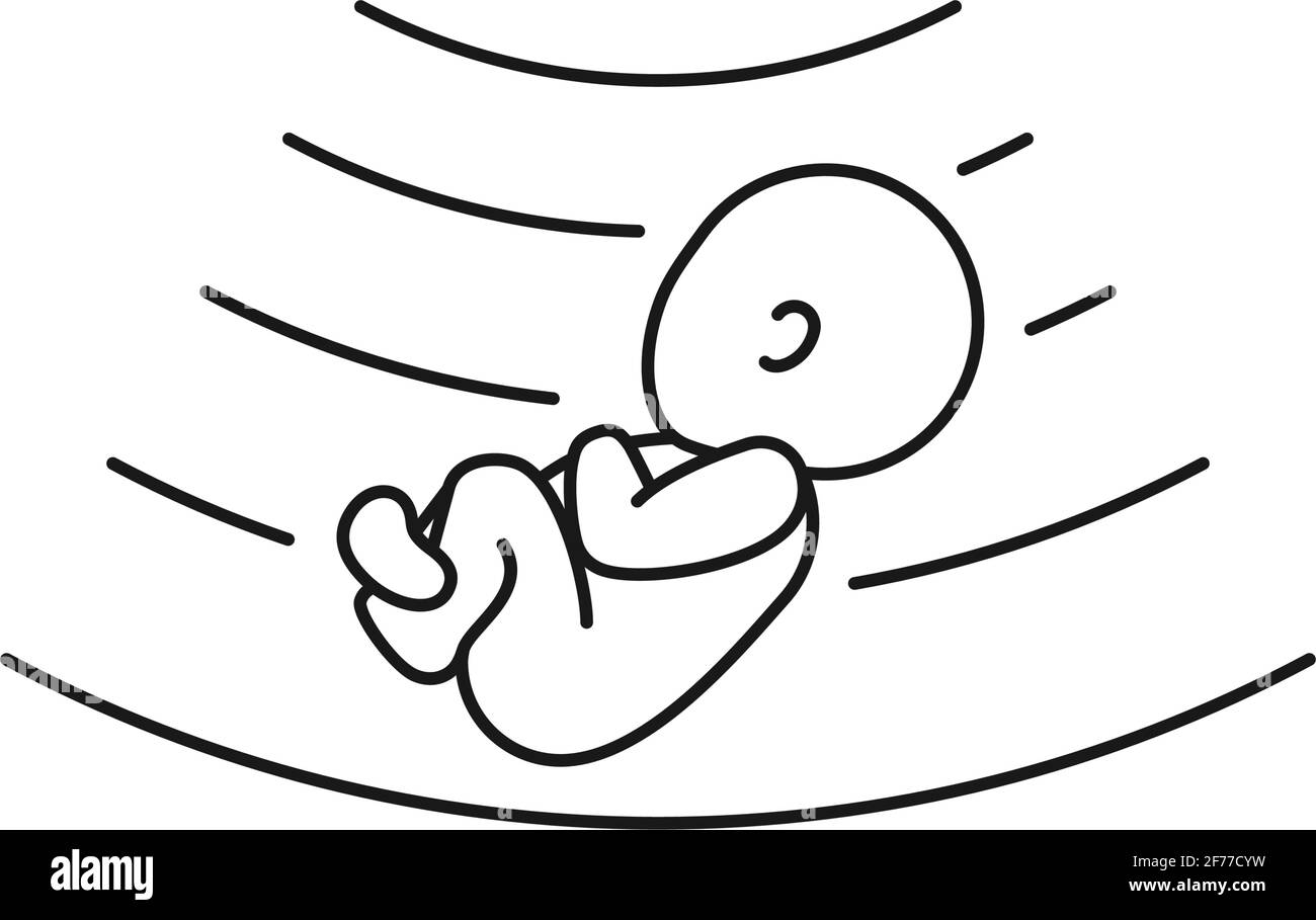 Baby sonogram or fetal utrasound scan image for pregnancy concept in ...