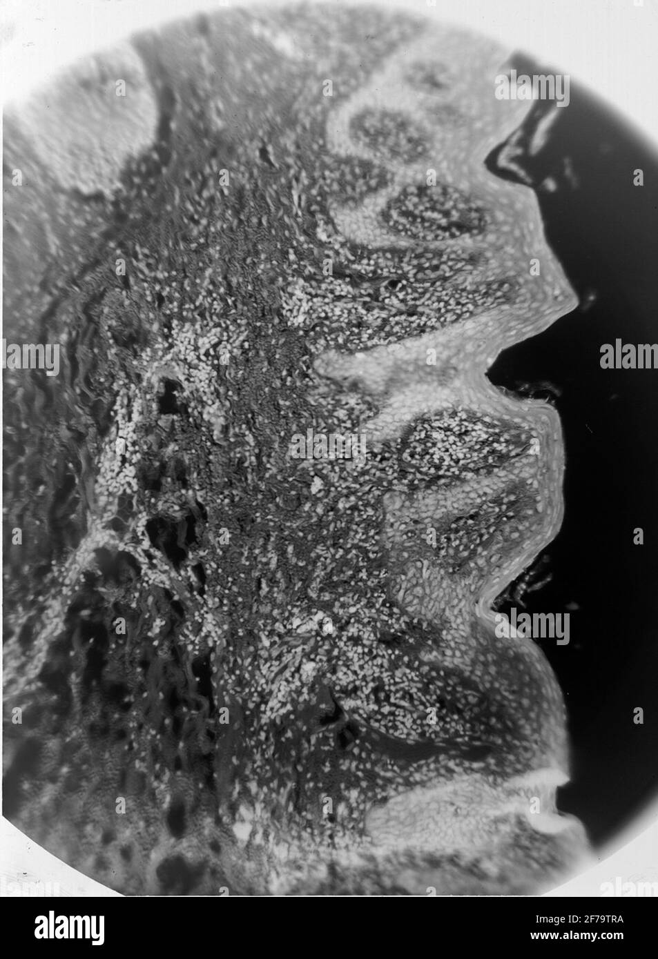 Micrograph Black and White Stock Photos & Images - Alamy