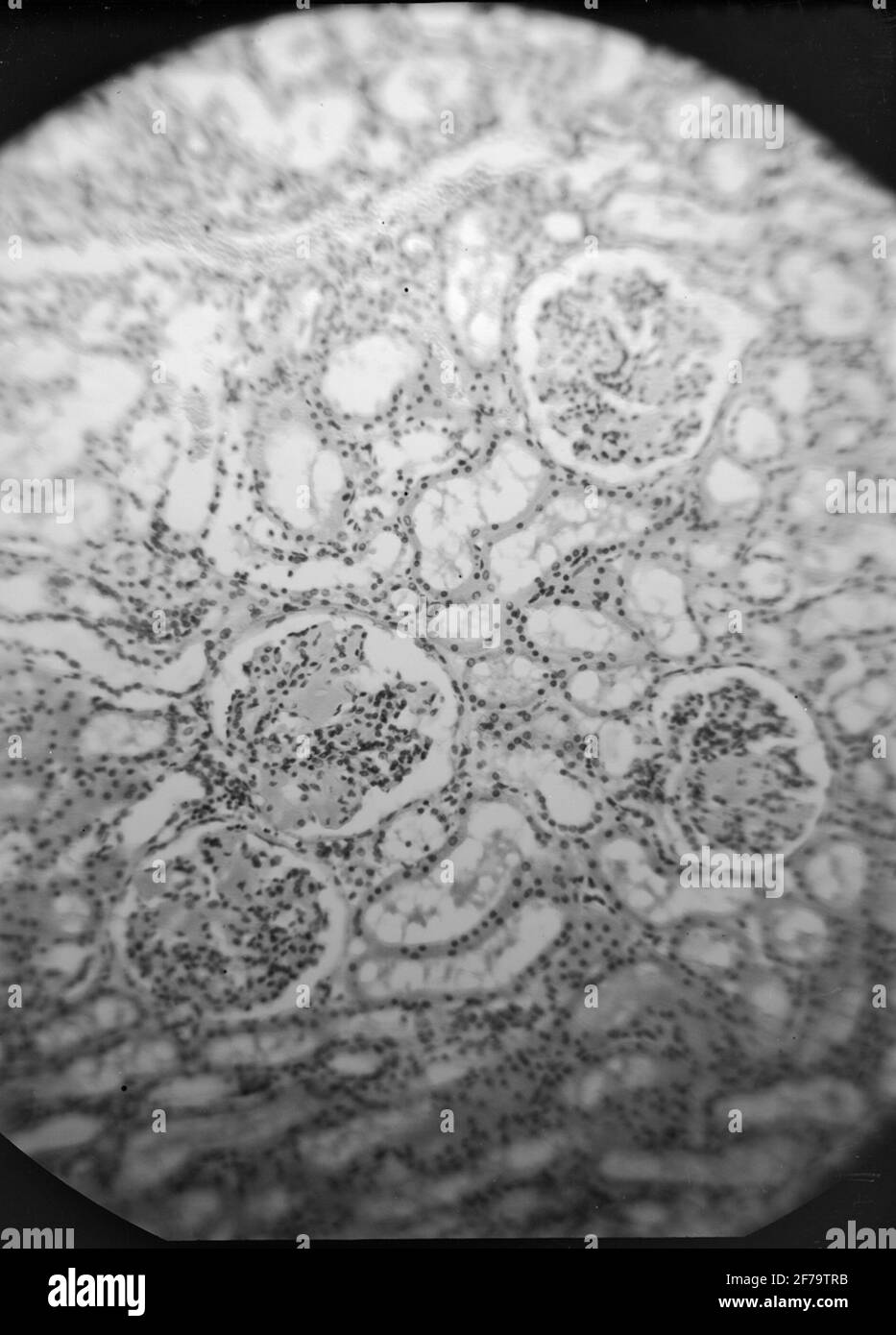 Micrograph Black and White Stock Photos & Images - Alamy
